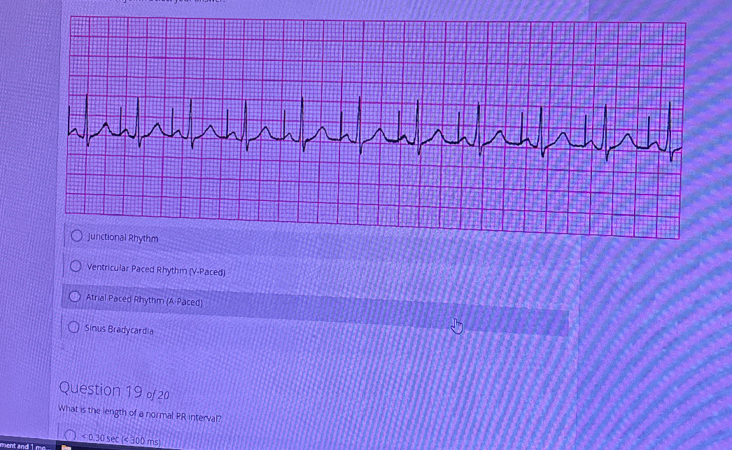 Junctional Rhythm Ventricular Paced Rhythm | StudyX