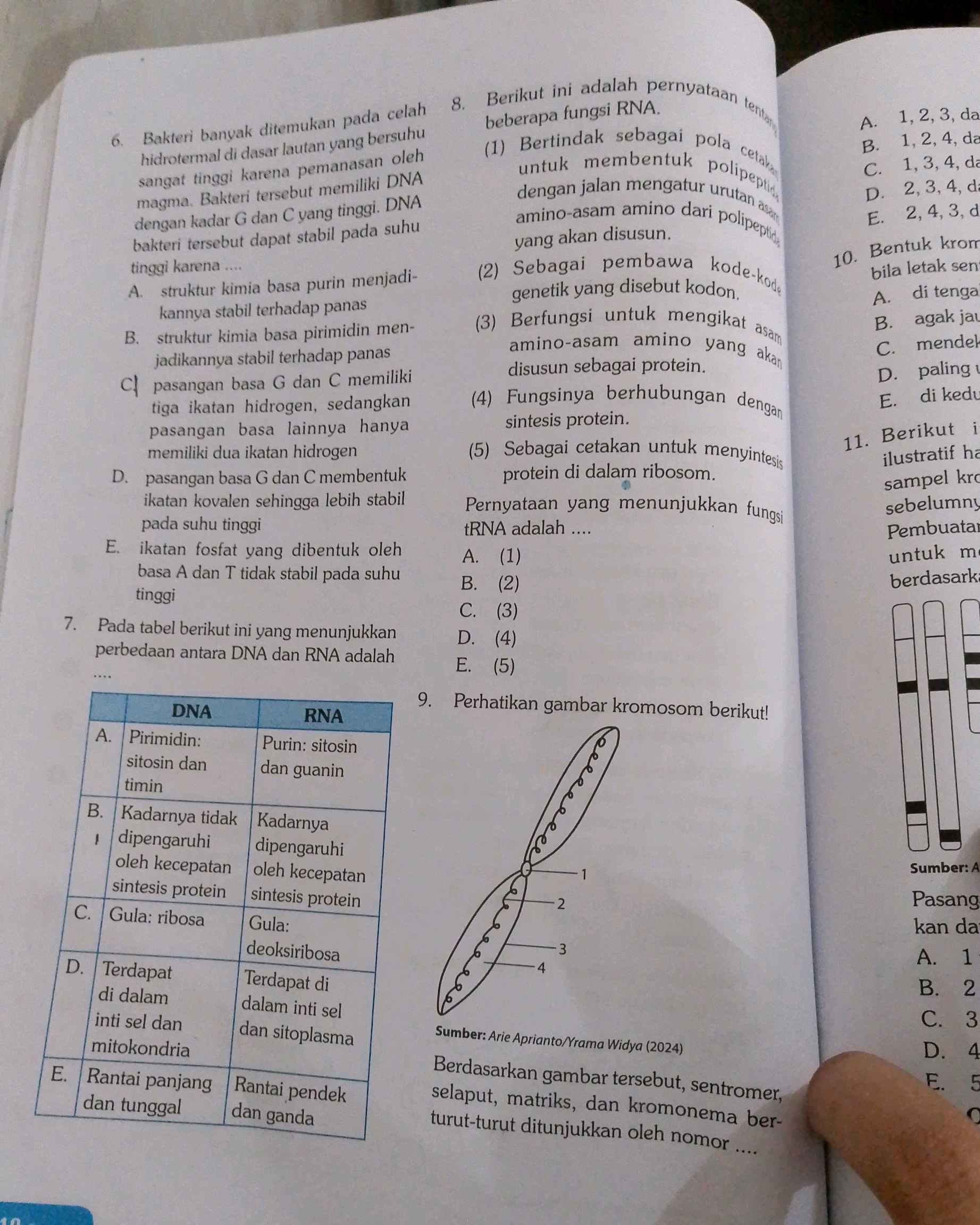 Perhatikan gambar kromosom berikut! [Gambar | StudyX