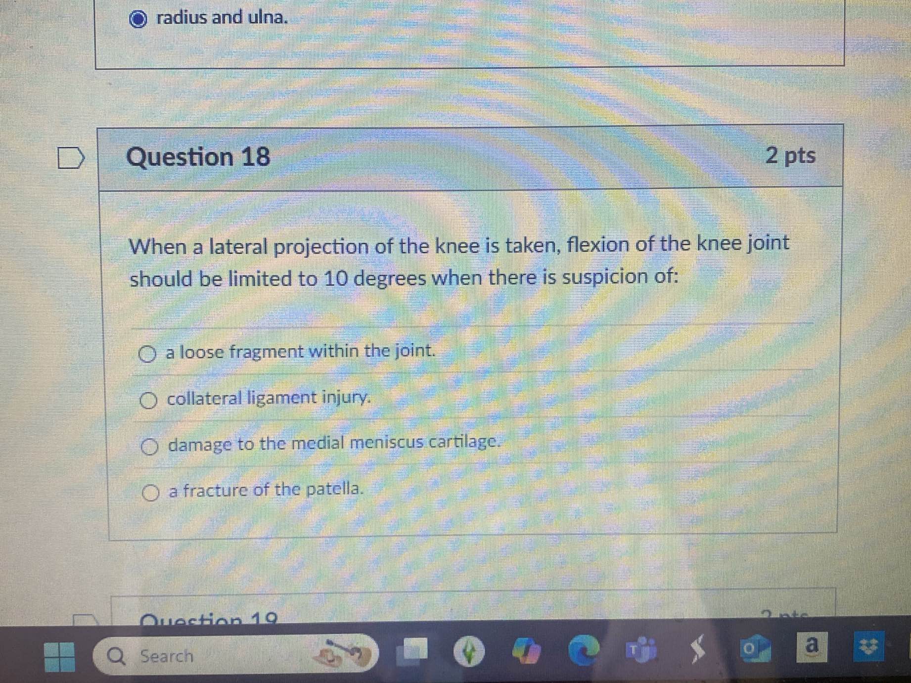 When a lateral projection of the knee is | StudyX