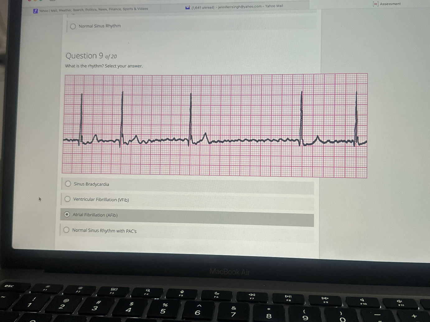 Question 9 of 20 What is the rhythm? Select | StudyX
