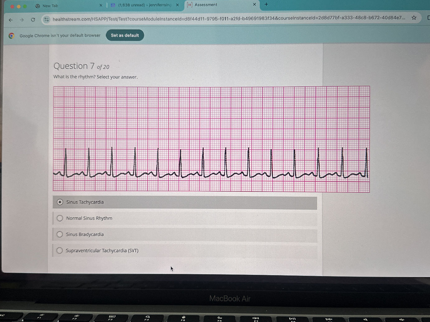 Question 7 of 20 What is the rhythm? Select | StudyX