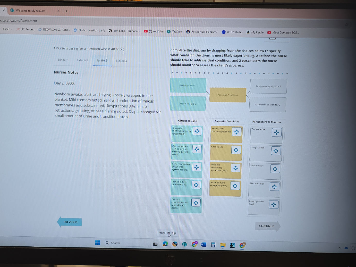 A nurse is caring for a newborn who is 48 hr | StudyX