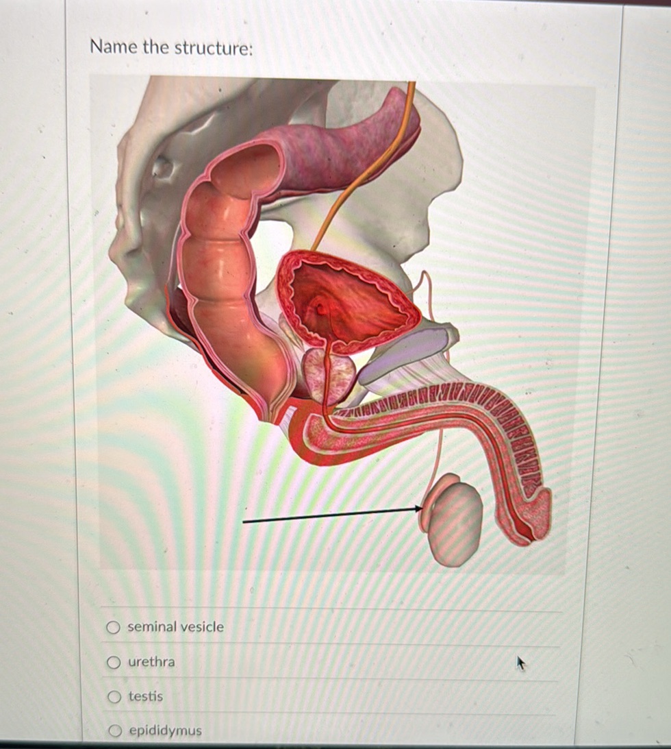 Name the structure: * seminal vesicle * | StudyX