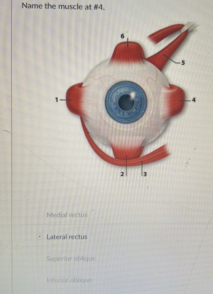 Name the muscle at #4. Medial rectus | StudyX