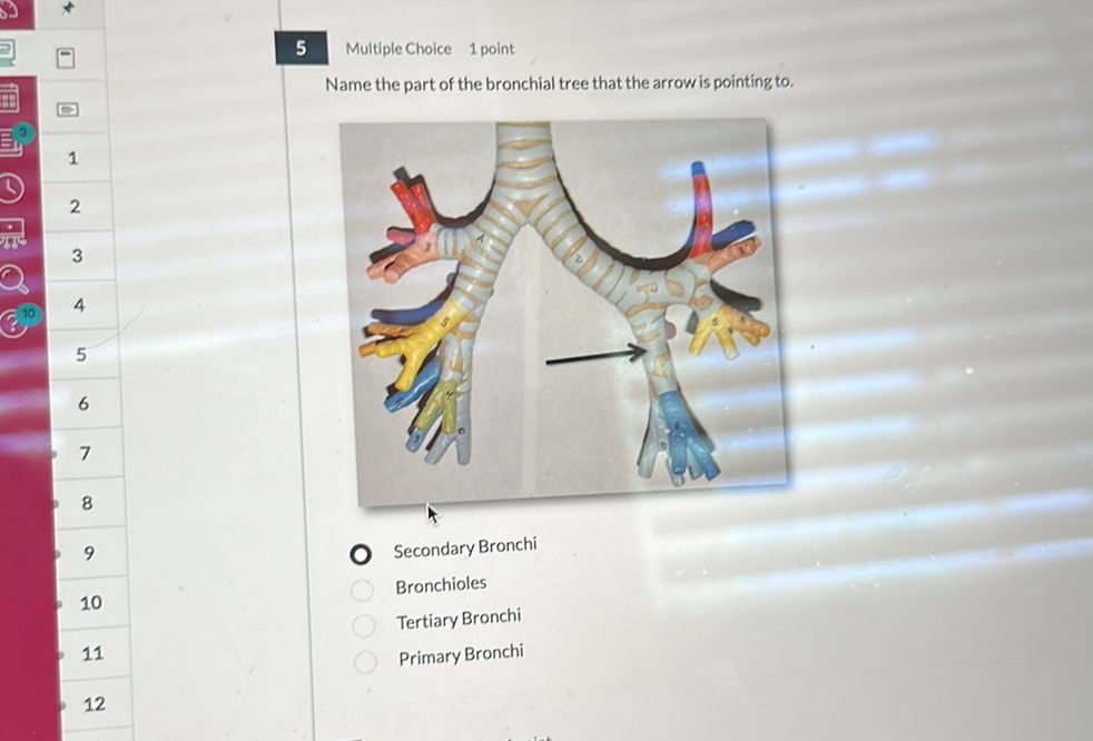 Name the part of the bronchial tree that the | StudyX