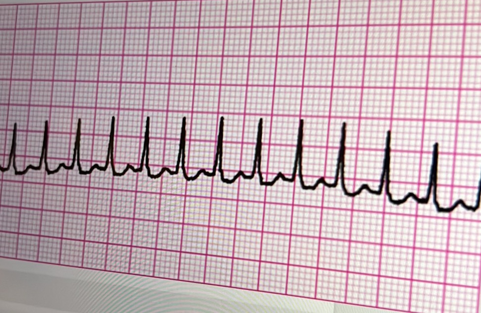 The image shows an electrocardiogram (ECG) | StudyX