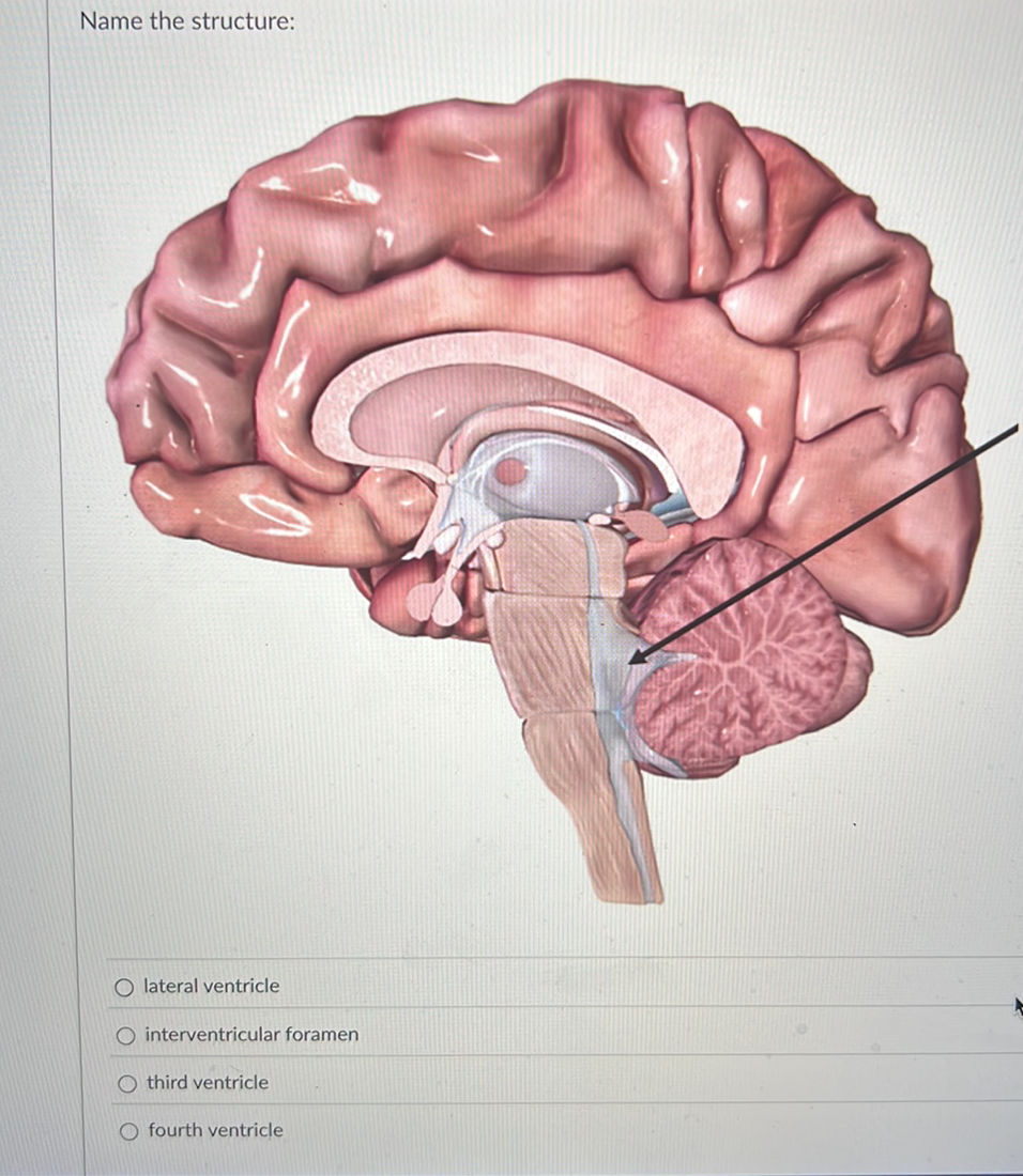 Name the structure: * lateral ventricle * | StudyX