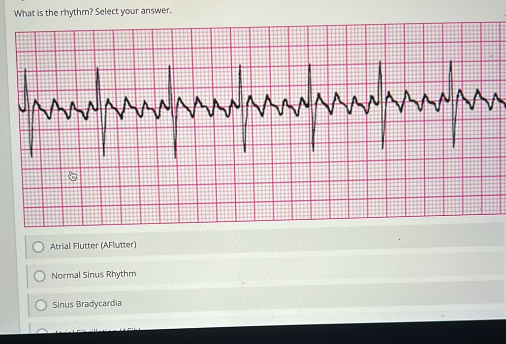 What is the rhythm? Select your answer. | StudyX