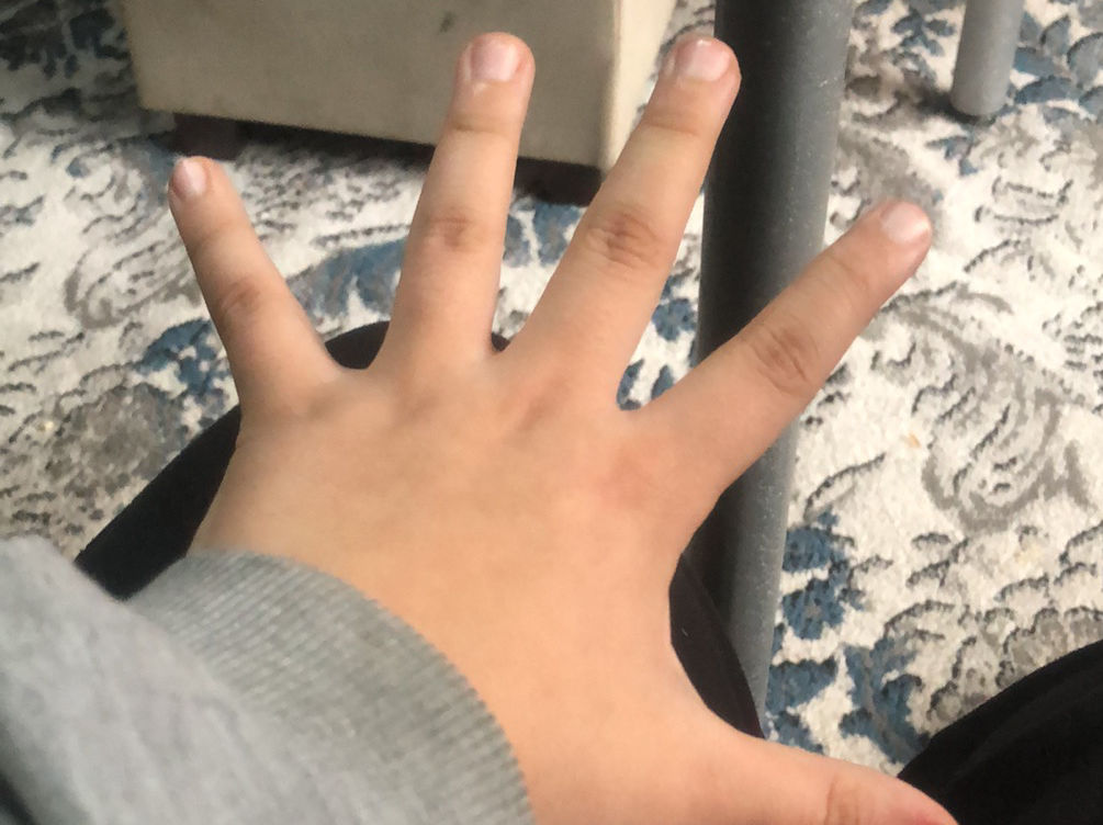 How many fingers are shown in the image? | StudyX