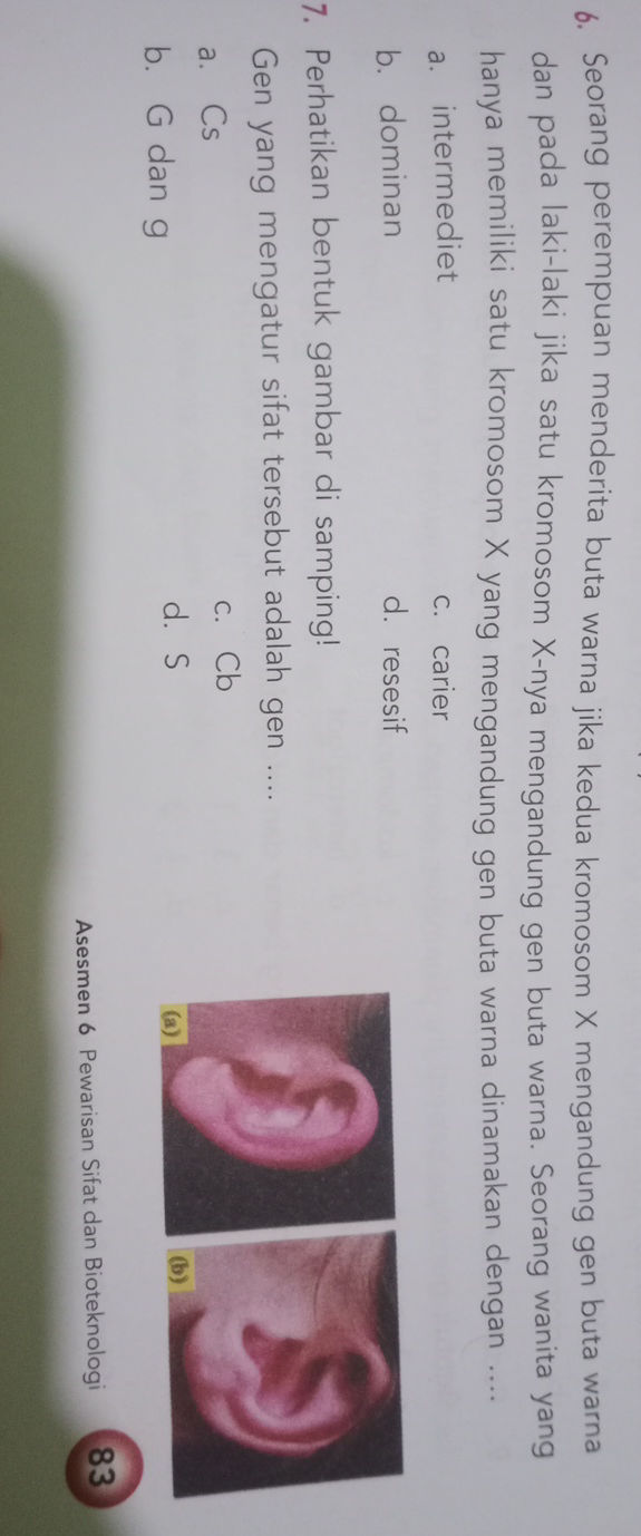 6. Seorang perempuan menderita buta warna | StudyX