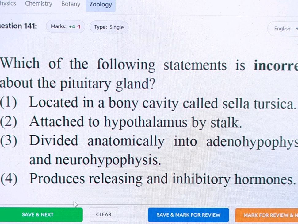 Which of the following statements is | StudyX