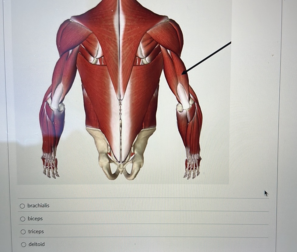 Which muscle is indicated by the arrow? | StudyX