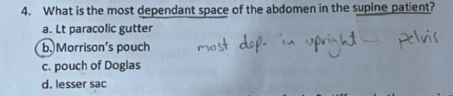 4. What is the most dependant space of the | StudyX