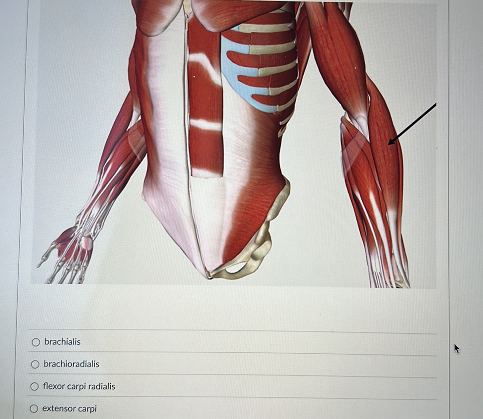 Which muscle is indicated by the arrow? * | StudyX