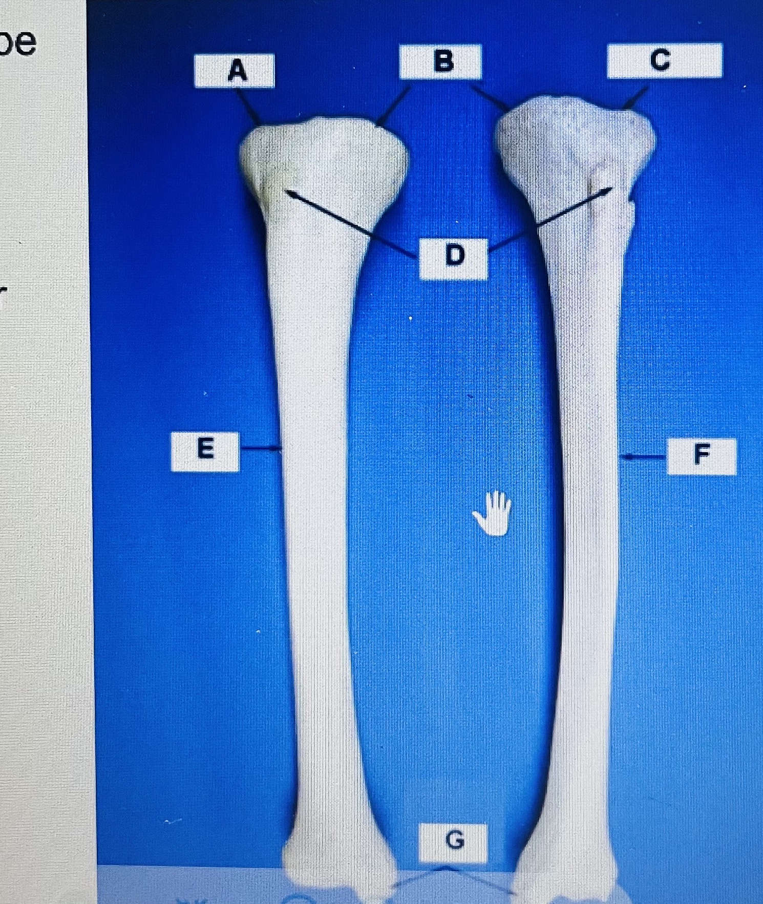 Identify the labeled parts of the bone. A, | StudyX