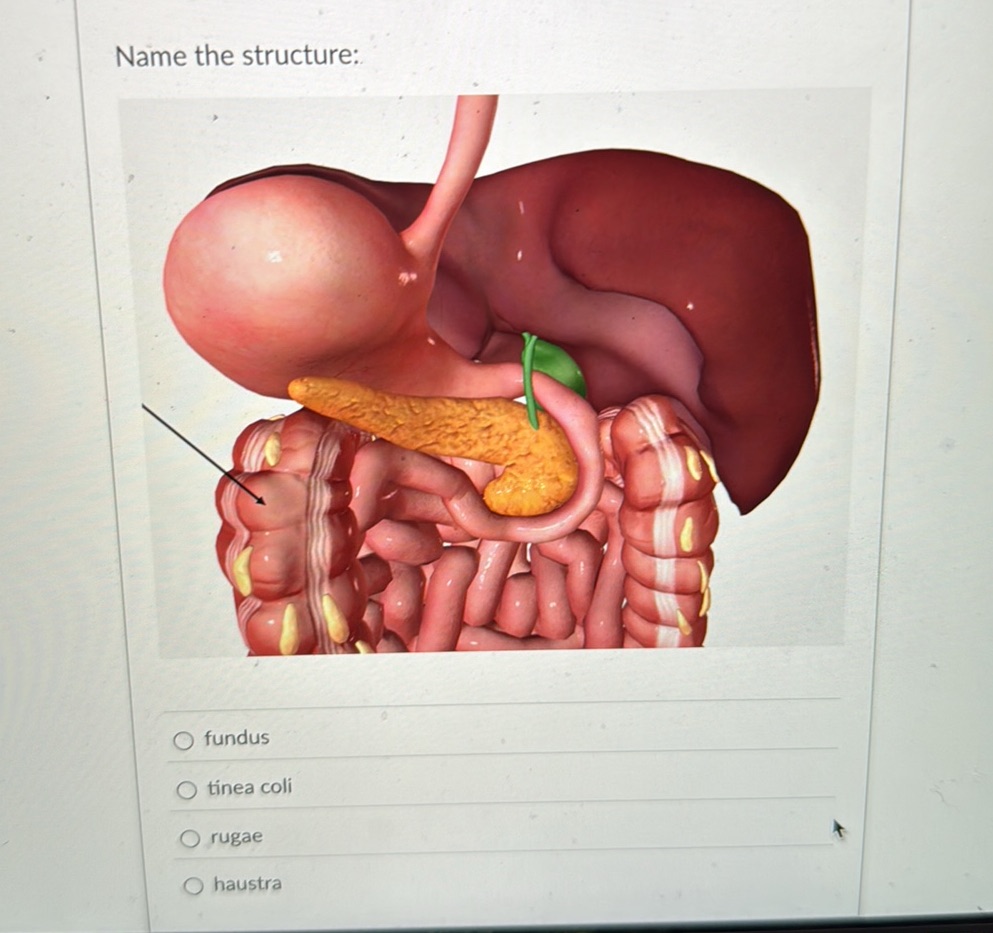 Name the structure: * fundus * tinea | StudyX