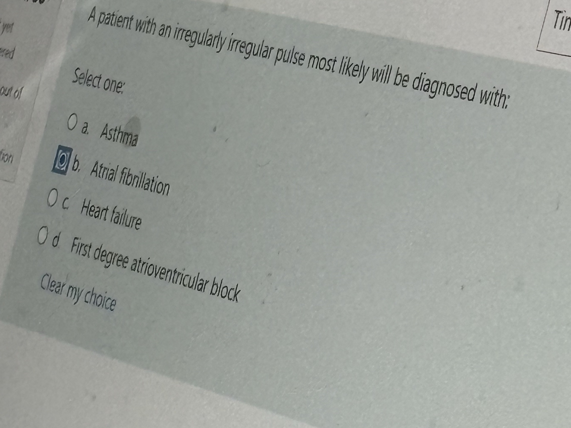 A patient with an irregularly irregular | StudyX