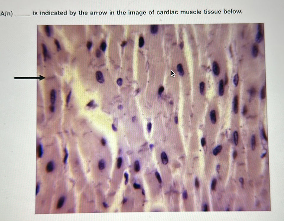 A(n) ______ is indicated by the arrow in the | StudyX