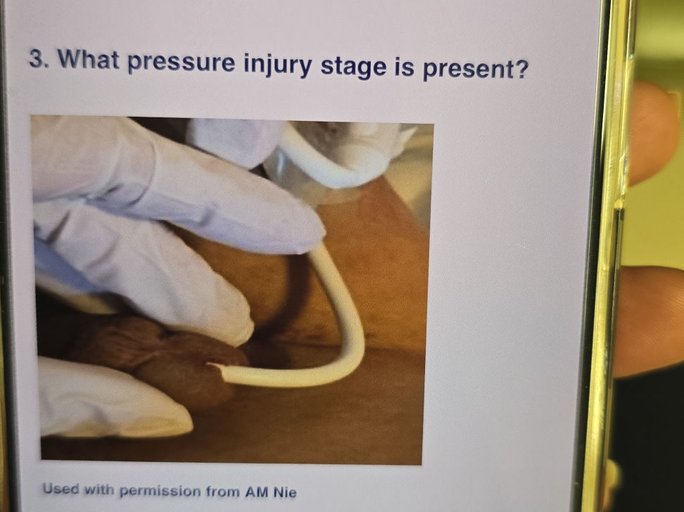 3. What pressure injury stage is present? | StudyX