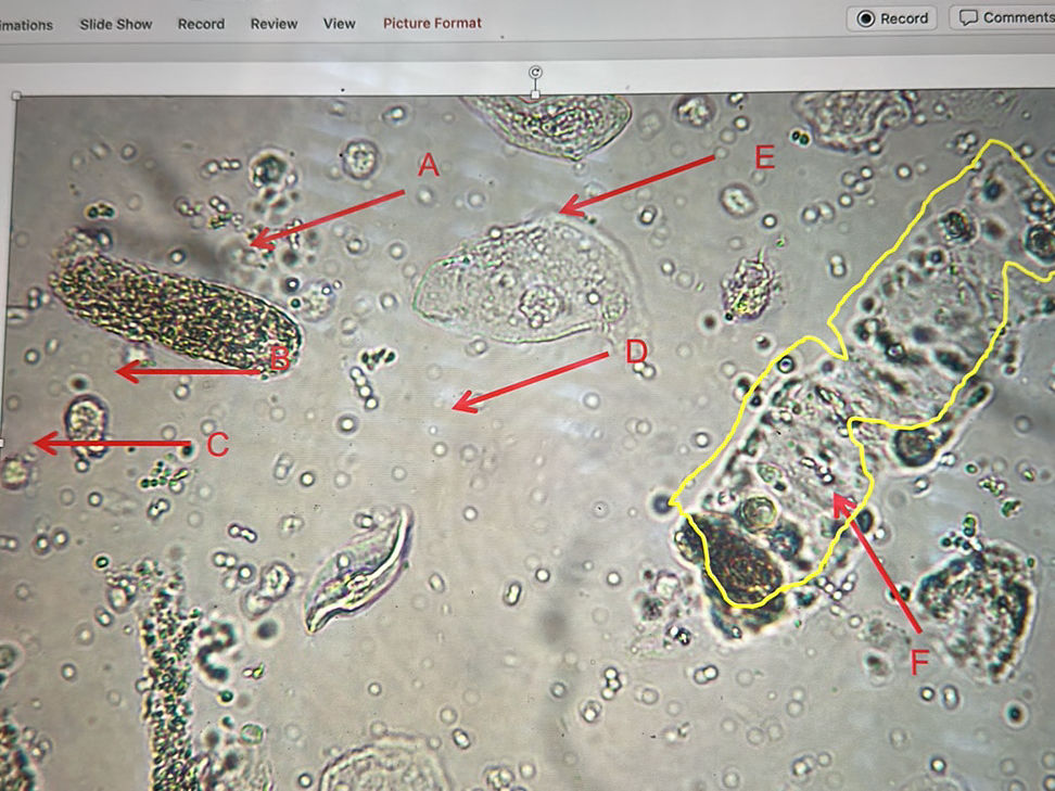 The image shows a microscopic view of a | StudyX