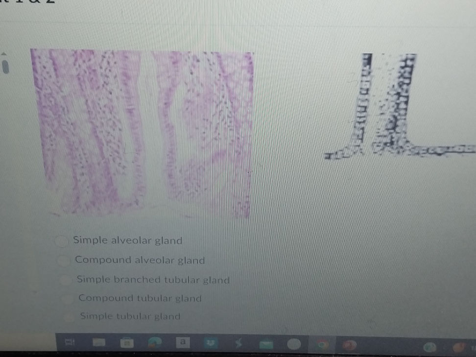 Simple alveolar gland Compound alveolar | StudyX