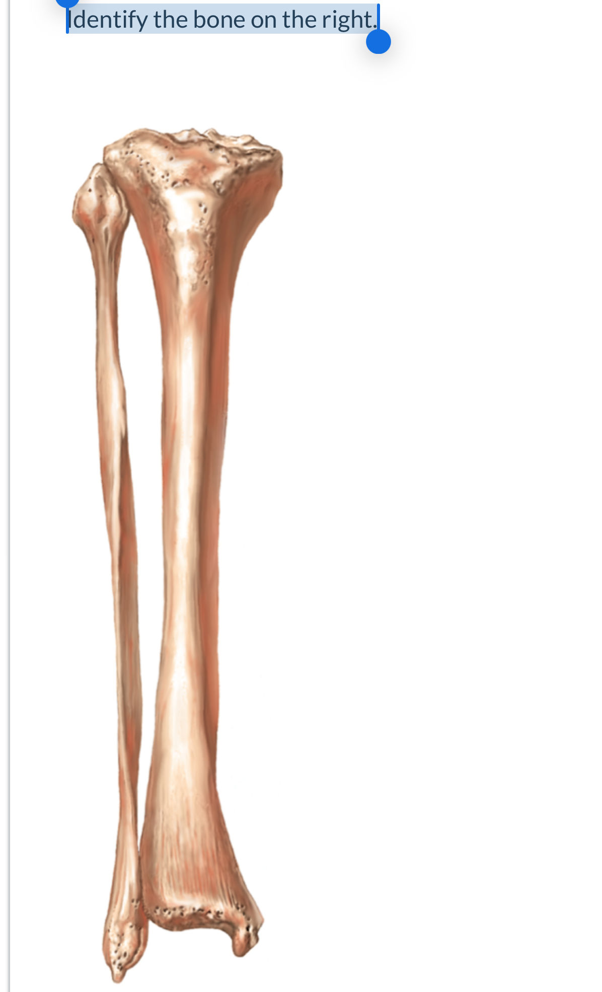 Identify the Tibia Bone | StudyX