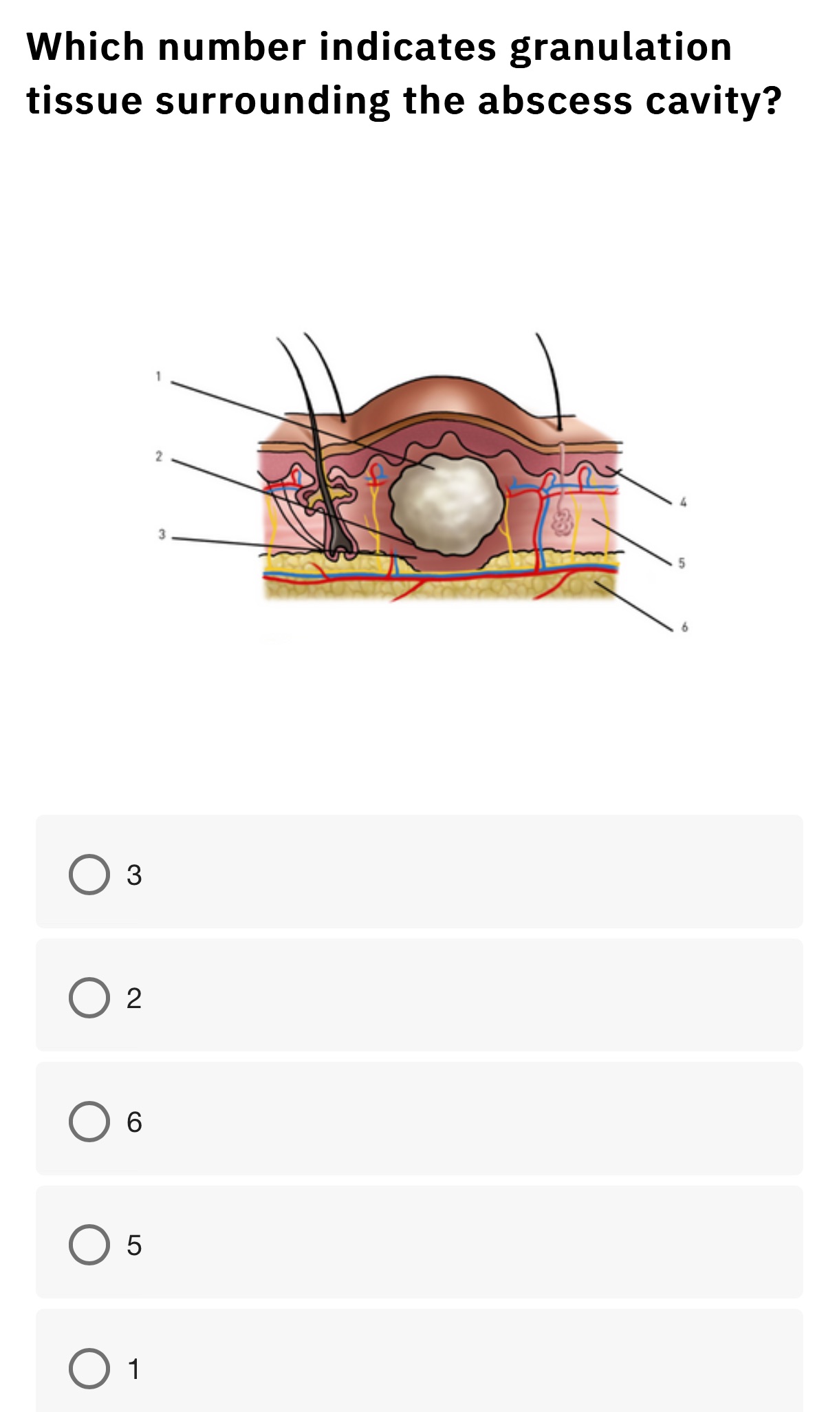 Which number indicates granulation tissue | StudyX