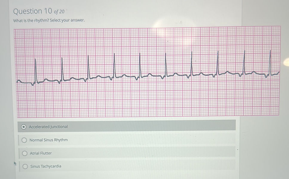 Question 10 of 20 What is the rhythm? Select | StudyX