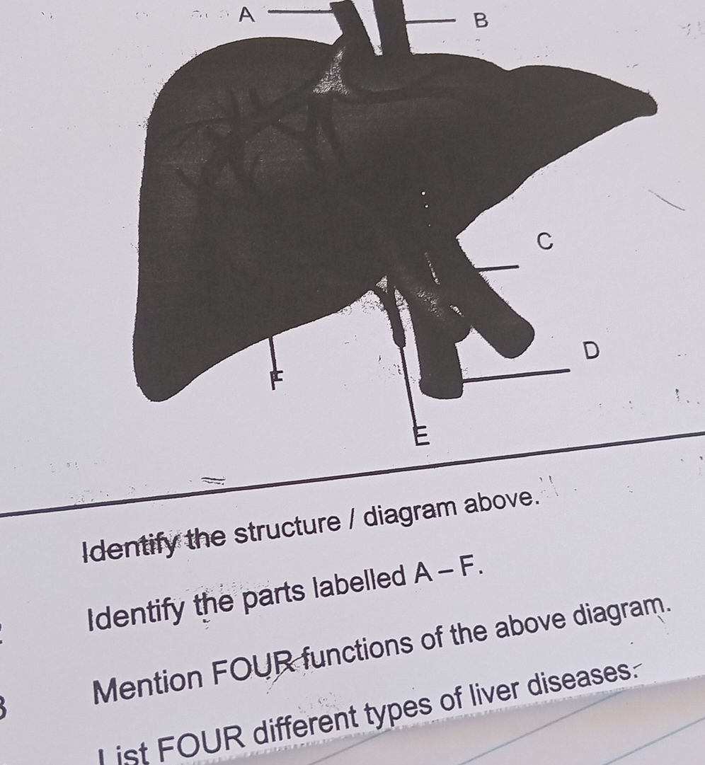Identify the structure / diagram above. | StudyX
