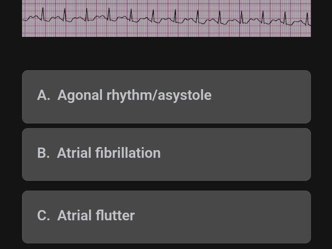 A. Agonal rhythm/asystole B. Atrial | StudyX