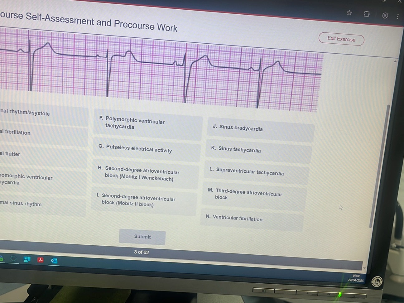 Match the following ECG rhythm strips with | StudyX