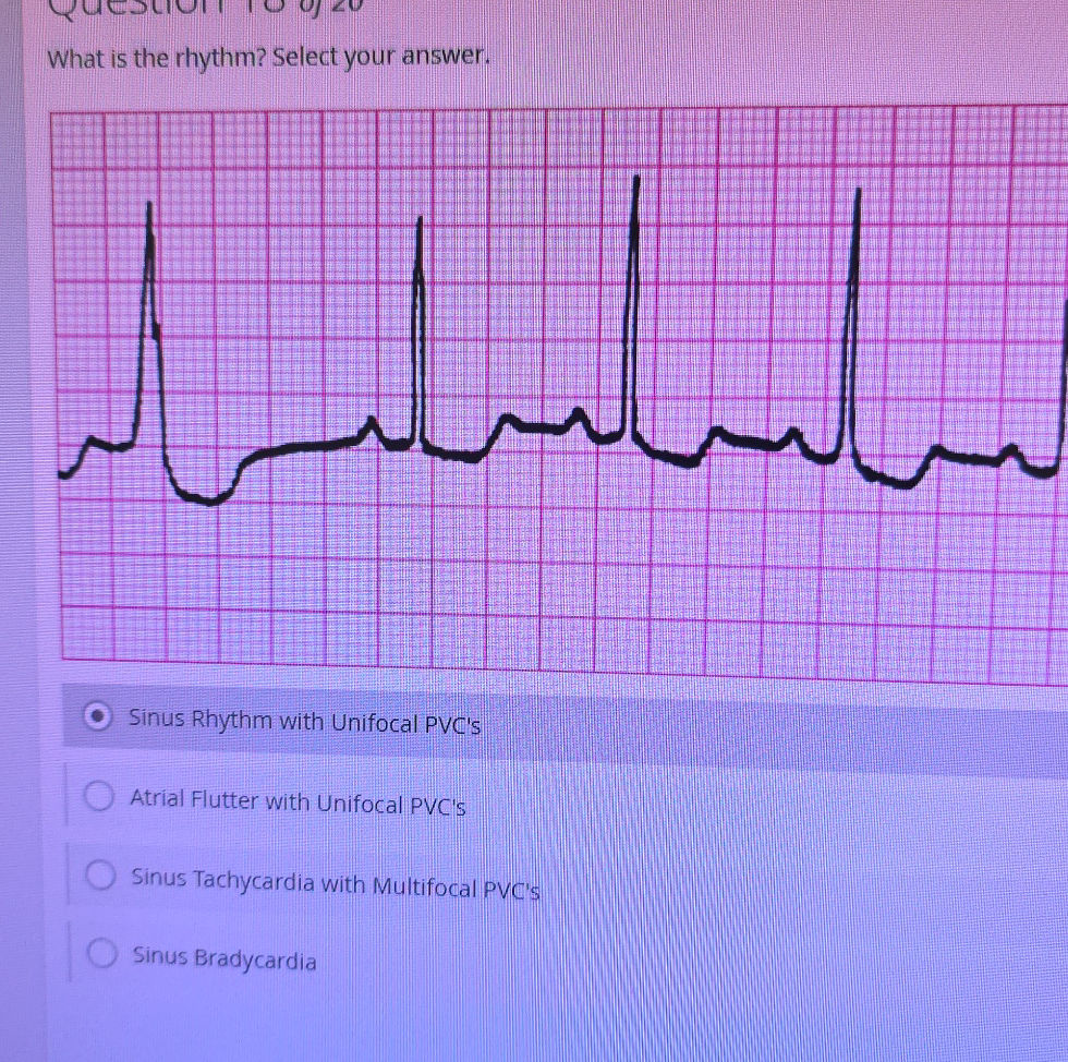 What is the rhythm? Select your answer. | StudyX