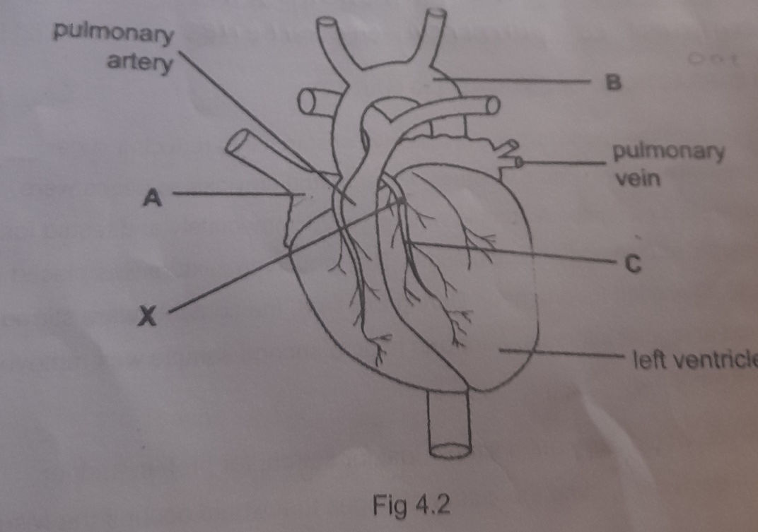 The image shows a diagram of a heart with | StudyX