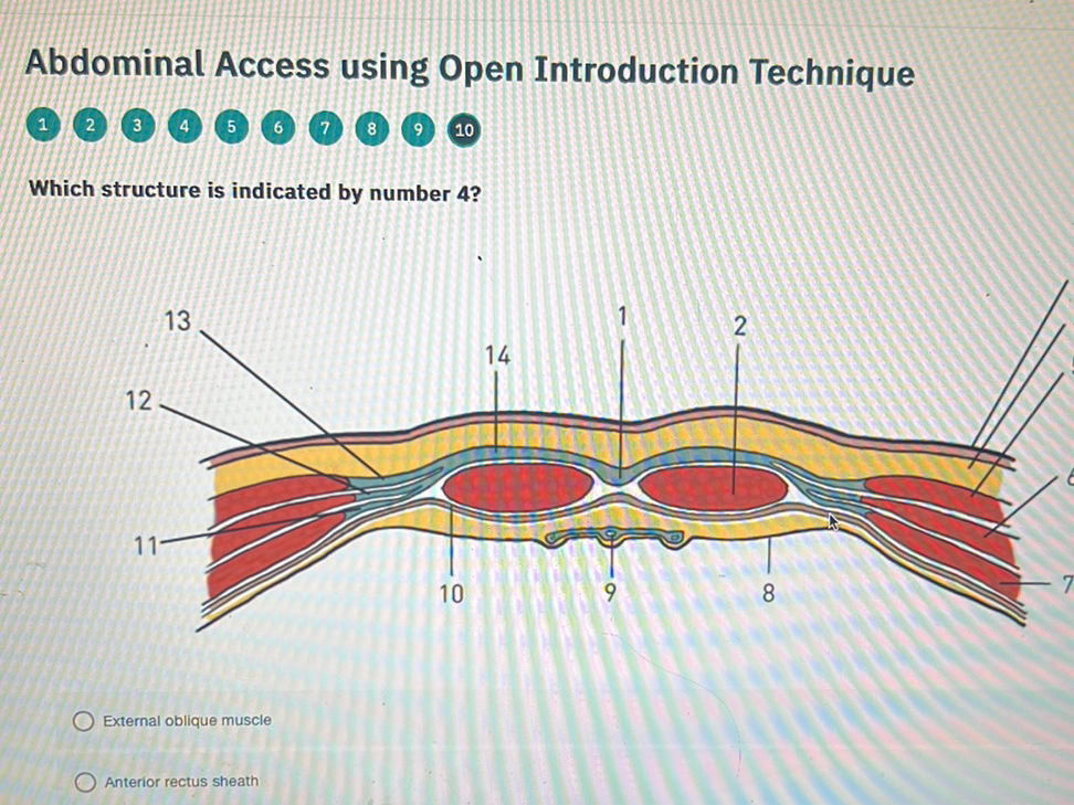 Which structure is indicated by number 4? | StudyX