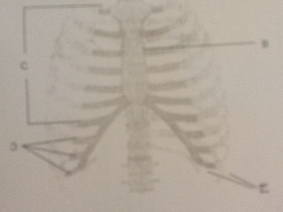 The image shows a diagram of the human rib | StudyX