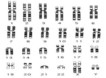 The image shows a karyotype. The question is | StudyX