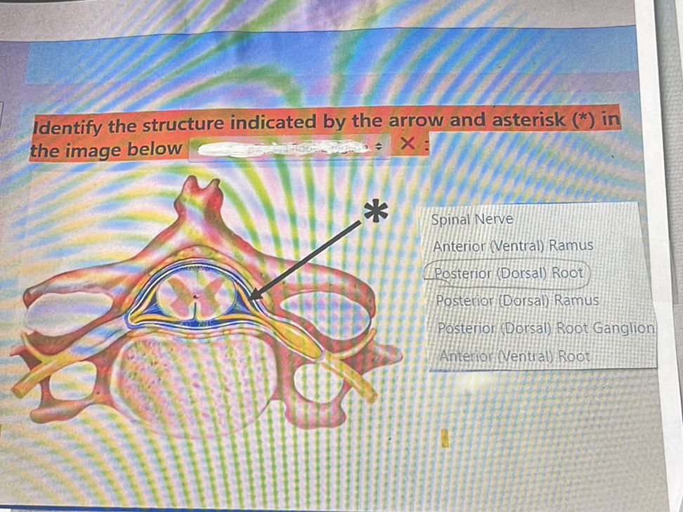 Identify the structure indicated by the | StudyX