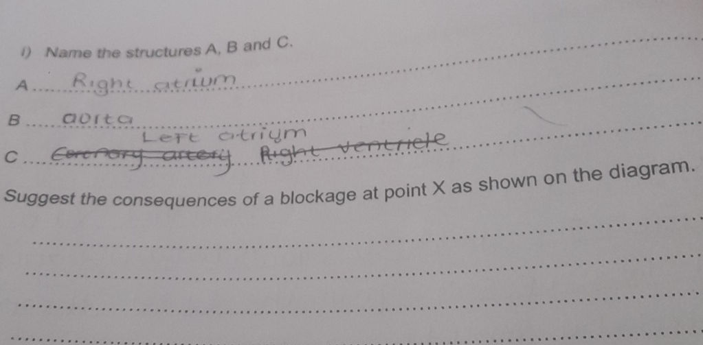 1) Name the structures A, B and C. A. Right | StudyX