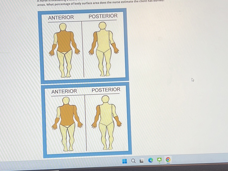 What percentage of body surface area does | StudyX