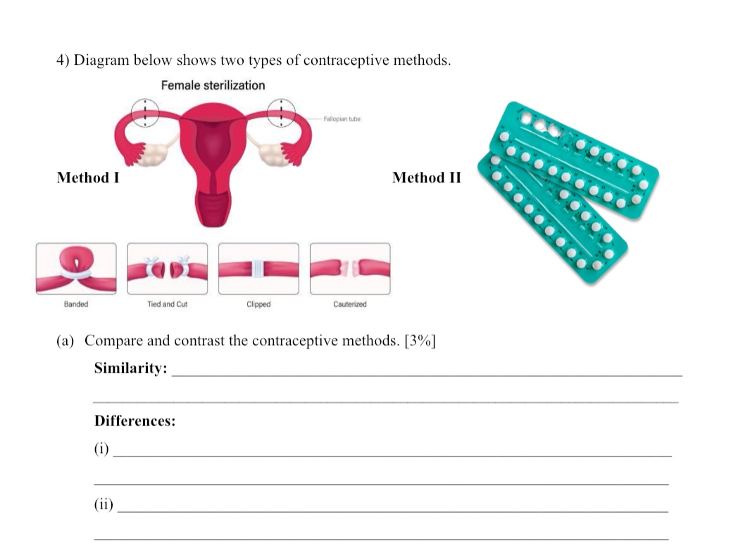4) Diagram below shows two types of | StudyX