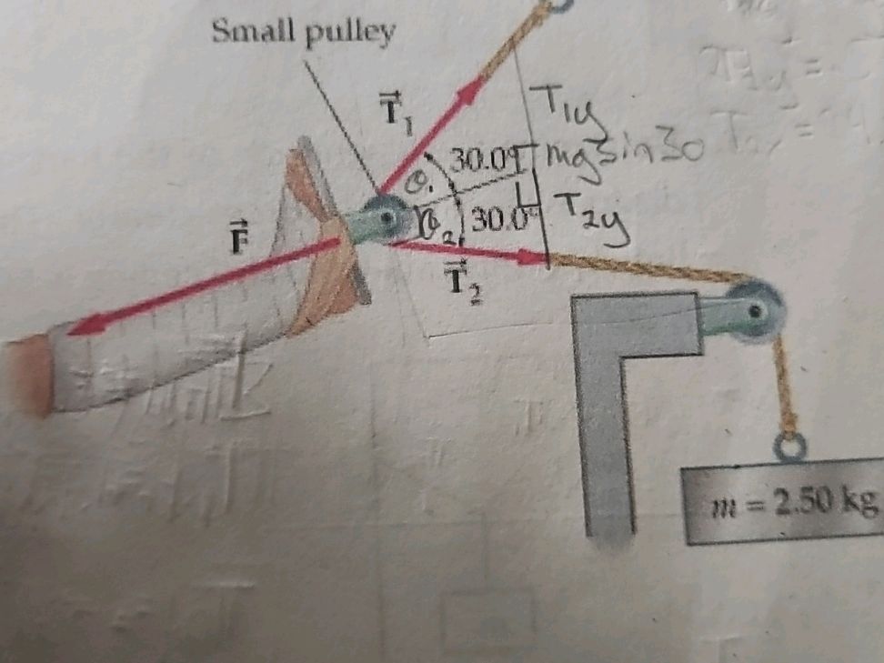 The image shows a diagram of a pulley system | StudyX