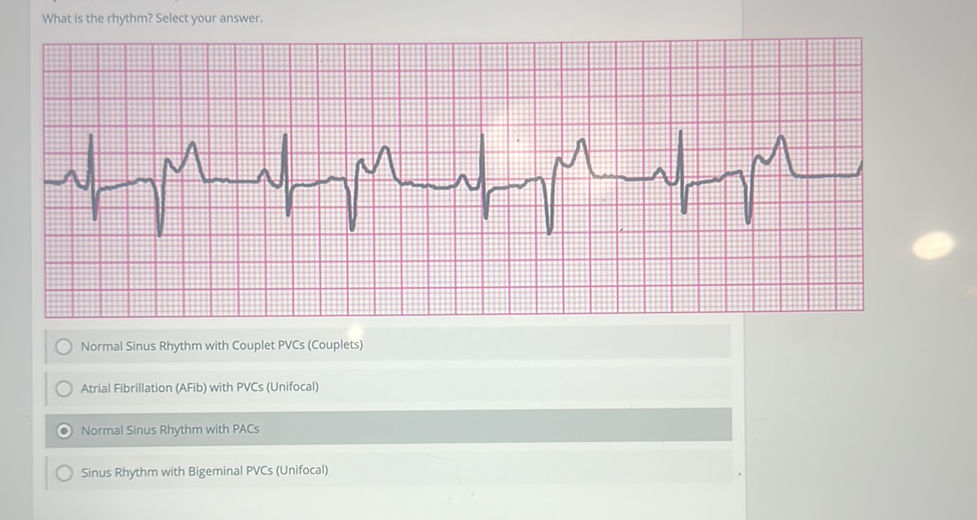 What is the rhythm? Select your answer. | StudyX