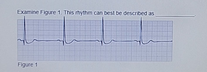 Examine Figure 1. This rhythm can best be | StudyX