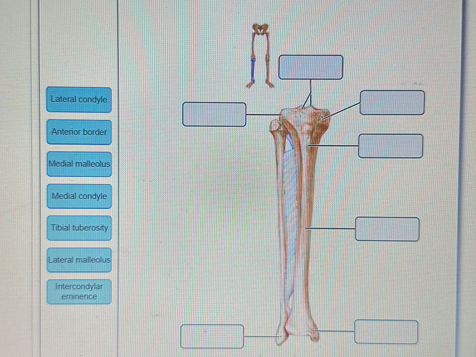 The image shows a diagram of a bone with | StudyX