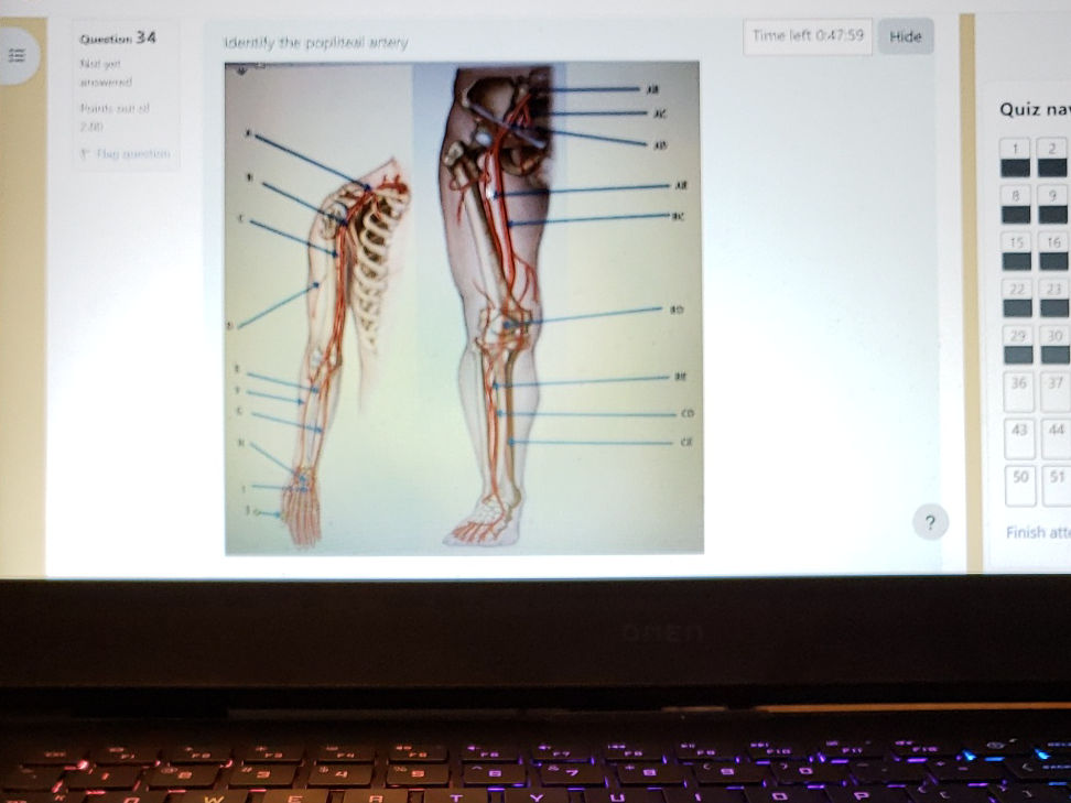 Identify the popliteal artery | StudyX