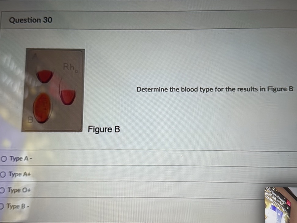 Determine the blood type for the results in | StudyX