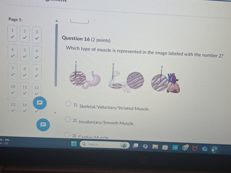 Question 16 (2 points) Which type of muscle