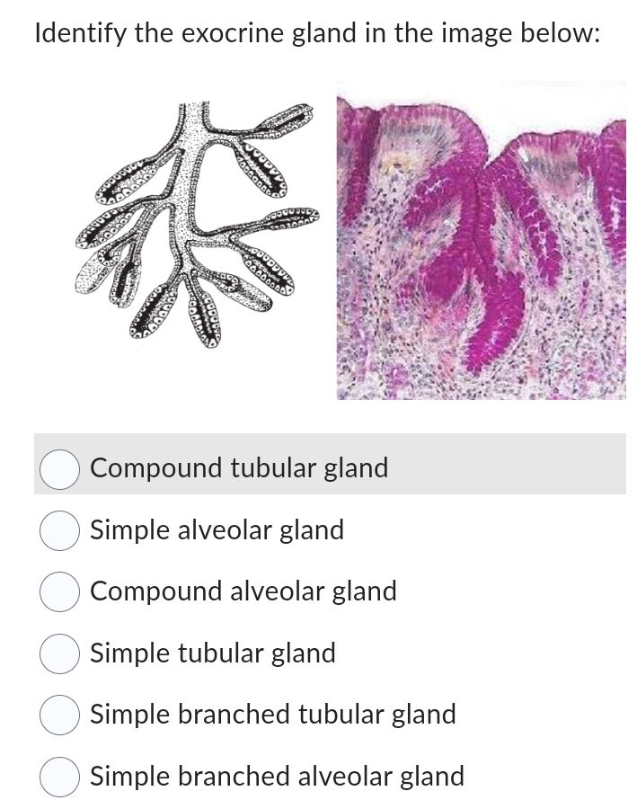 Identify the exocrine gland in the image | StudyX