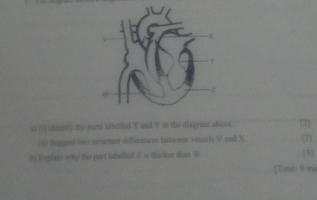 a) (i) Identify the parts labelled X and Y | StudyX