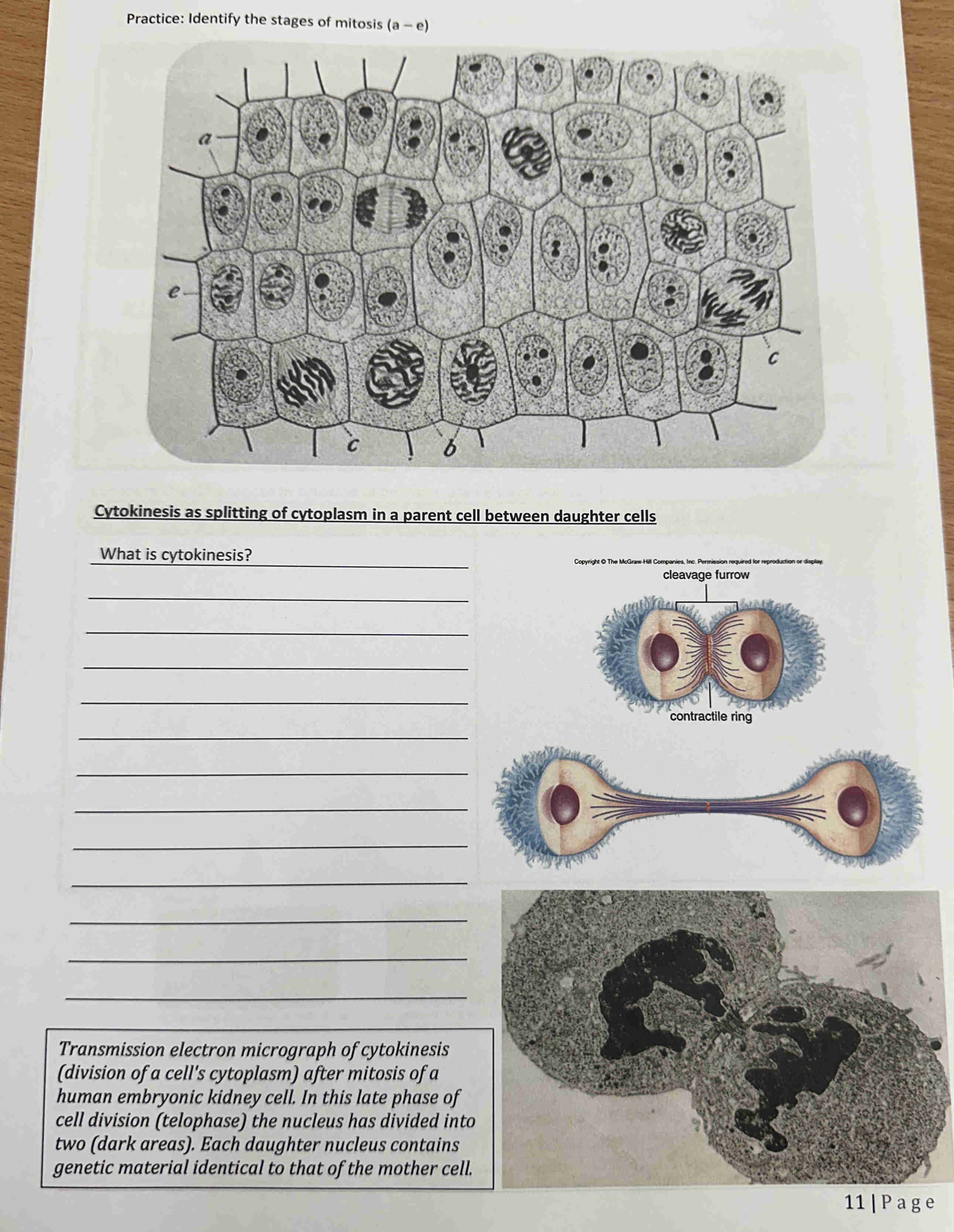 Practice: Identify the stages of mitosis (a | StudyX